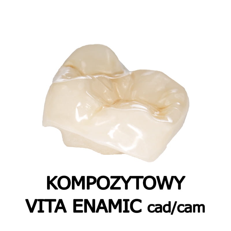 inlay/onlay kompozytowy Vita Enamic cad/cam 01 pkt Open Dental Lab